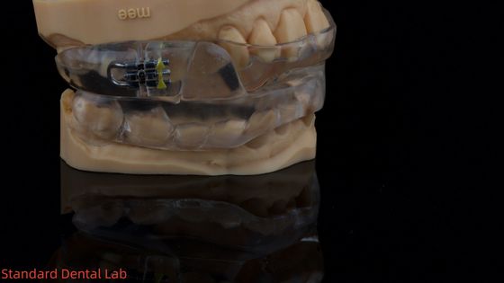 Orthodontics Appliance factory, Buy good quality Orthodontics Appliance ...