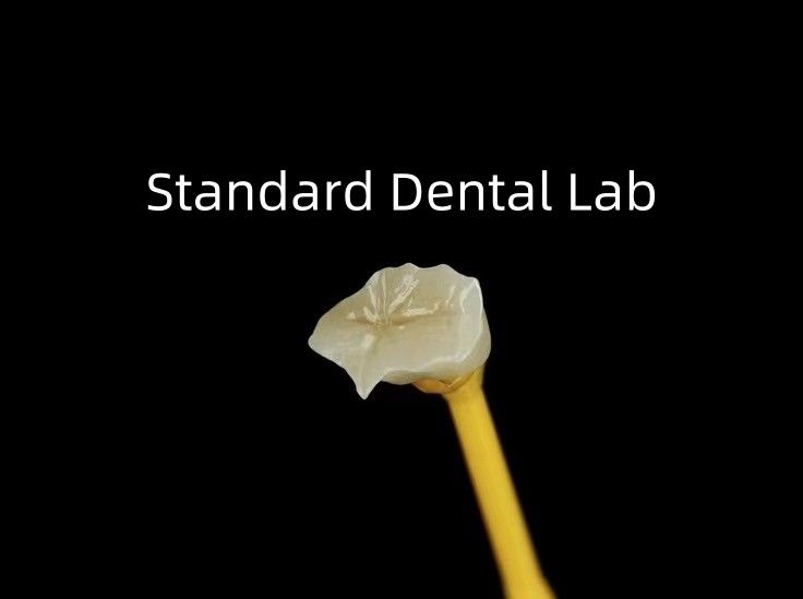 Dental Porcelain Inlay Onlay Zirconia Emax High Esthetics