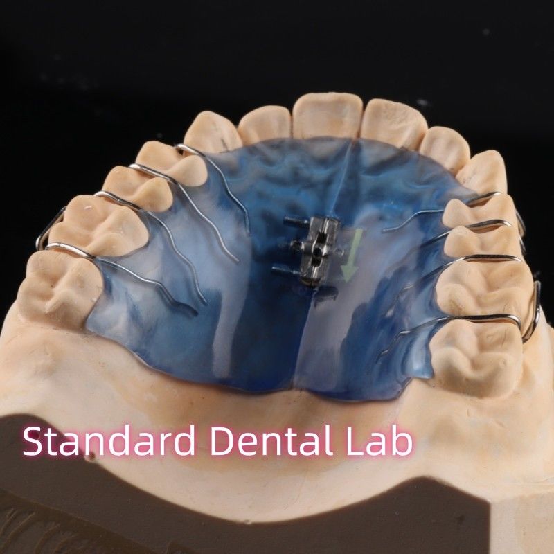Removable Palate Expander Appliance Orthodontics Professional For ...