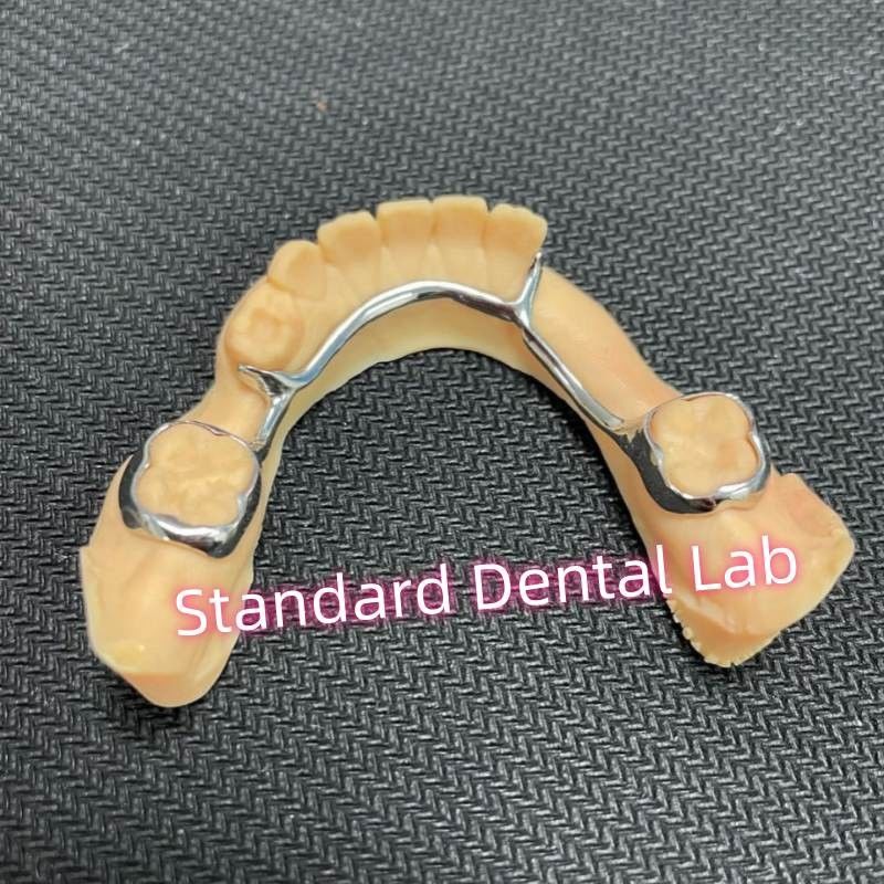 Dental Bilateral Space Maintainer For Missing Teeth Lingual Holding Arch