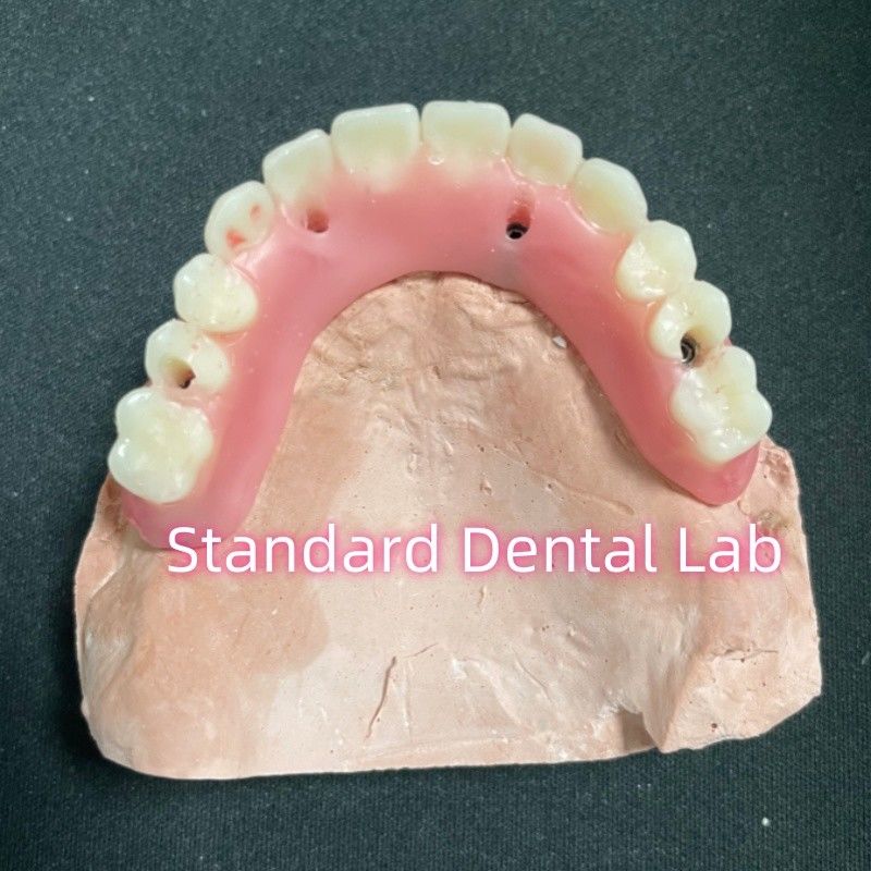 Acrylic Partial Implant Over Denture Titianium Bar Full Denture Teeth ...