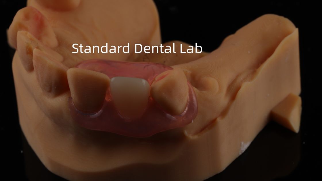 Dental TCS Valplast Flexible Partial Dentures Nesbit Valplast Finish China Dental Lab Valplast Clasp