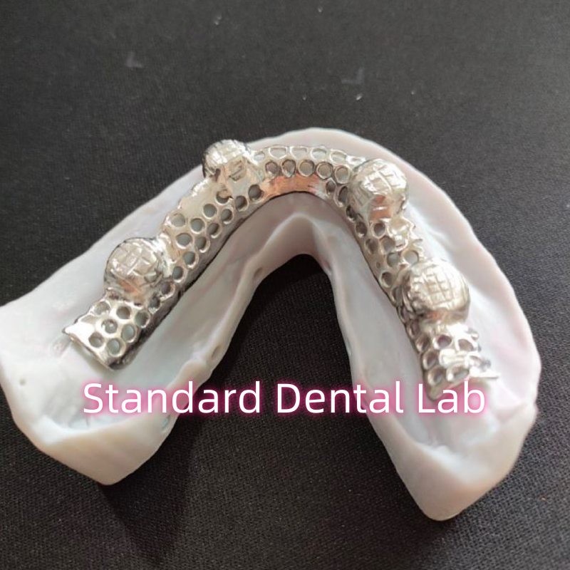 Cast Cobalt Chrome Metal Framework Partial Denture With Metal Frame