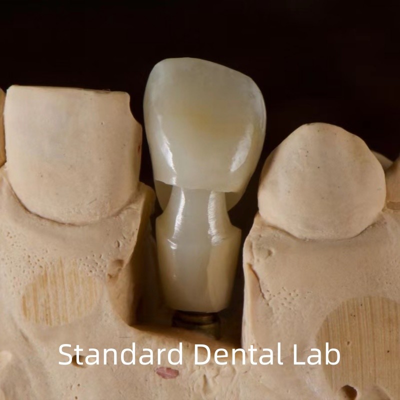 Dental Implant Tibase Zirconia Abutment Titanium Accuracy Customized