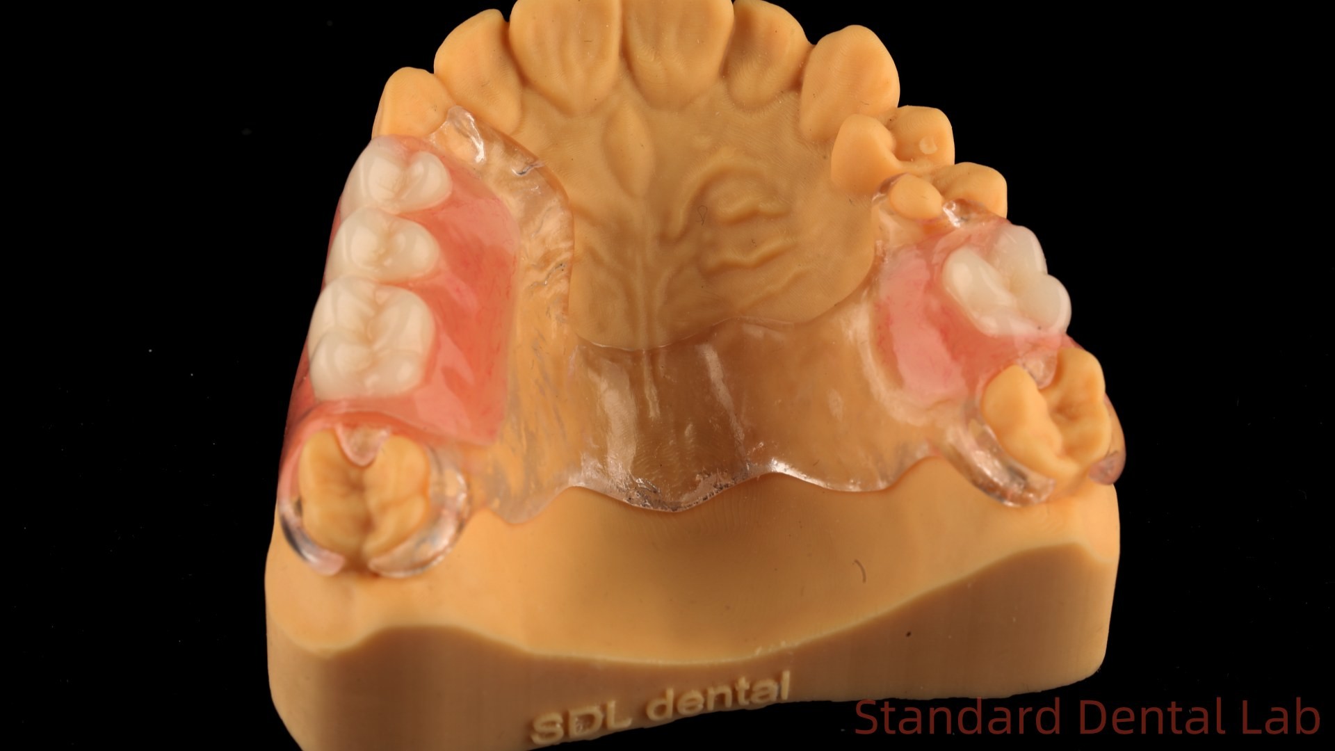 Flexible Clear Metal Cast Framework Partial Dentures High Esthetics ...