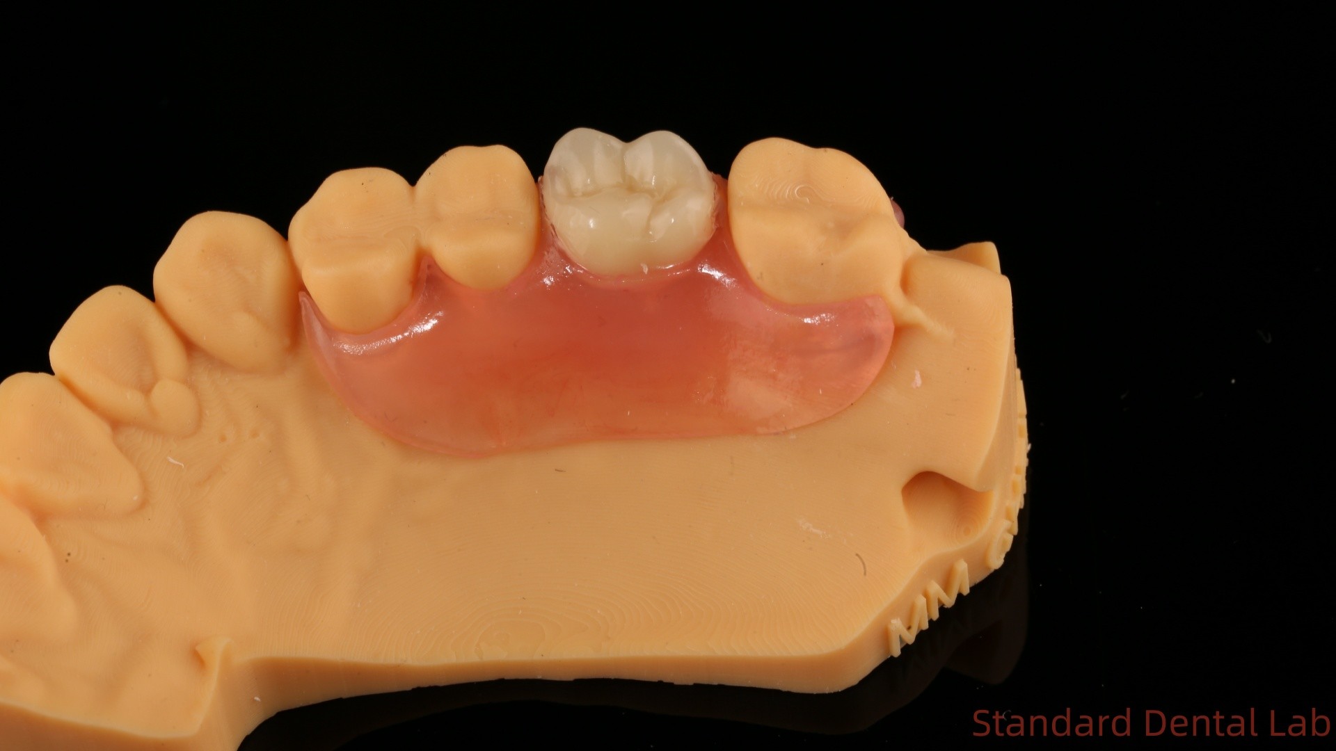 partial denture valplast