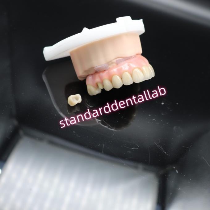 Digital Dental Malo Implant Bridge Titanium Ivoclar Hybrid Zirconia Bridge